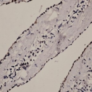 The mesothelium works magic to keep your body moving inside