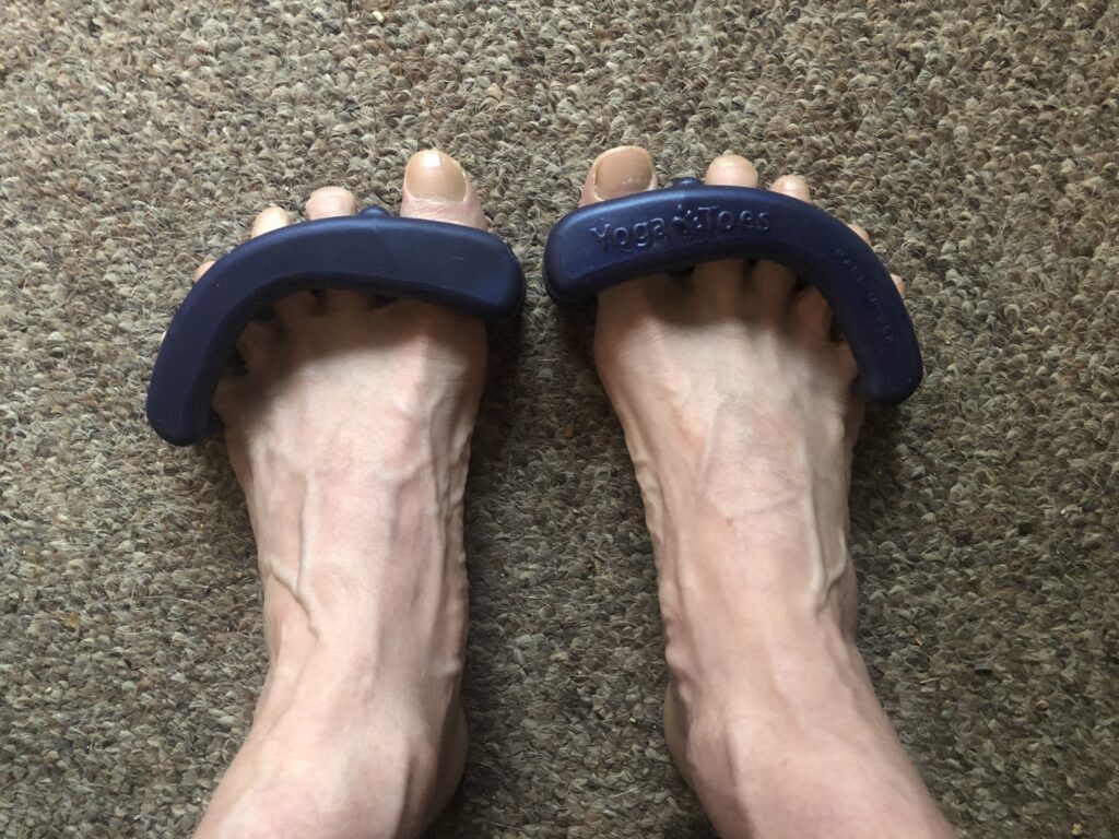 Optimal Foot Mechanics With Suboptimal Blood Flow? - Athlete With Stent